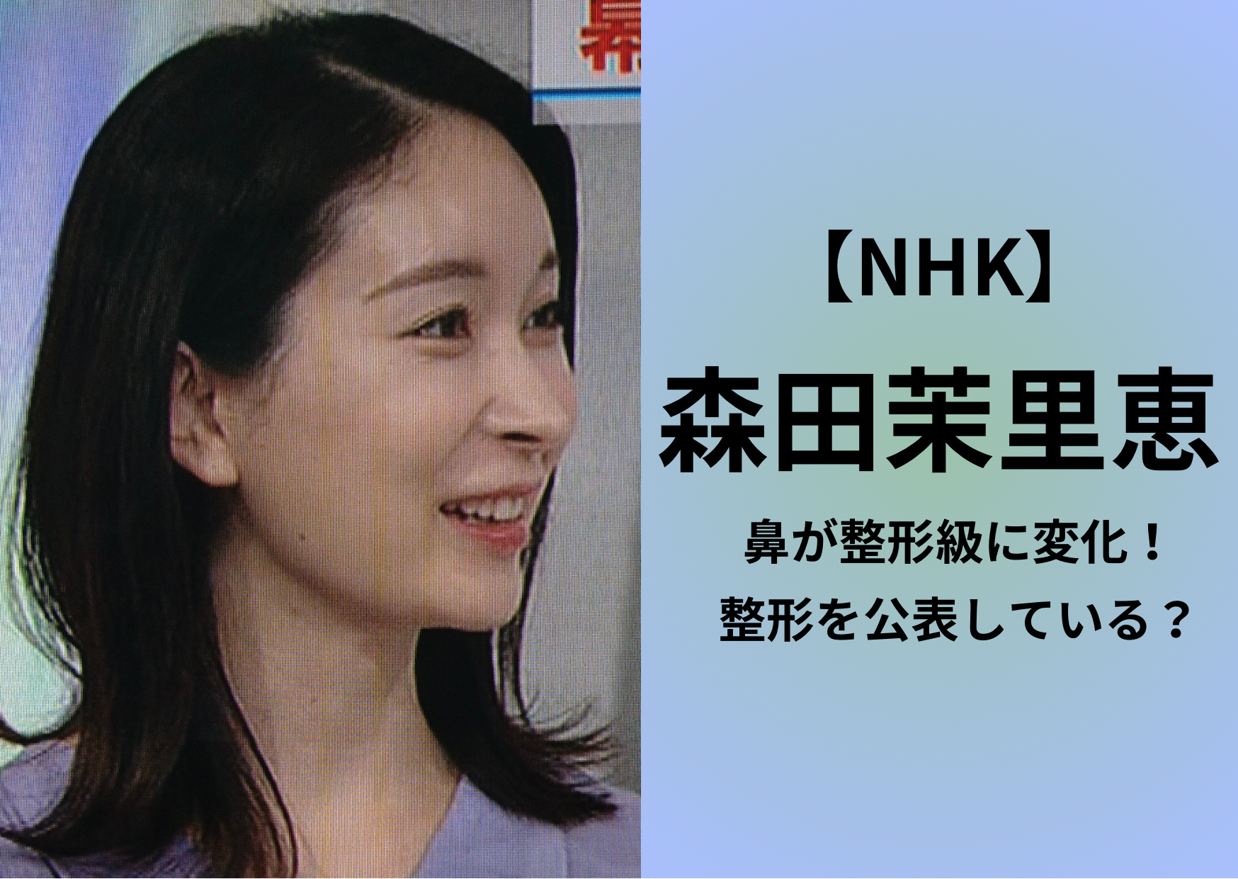 【画像】NHK森田茉里恵アナの鼻が整形級に変化！整形を公表している？